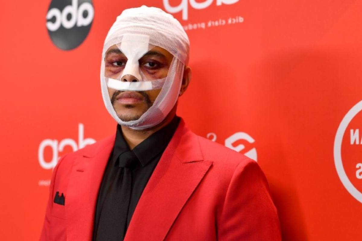 The Weeknd crea polémica al aparecer con exceso de botox